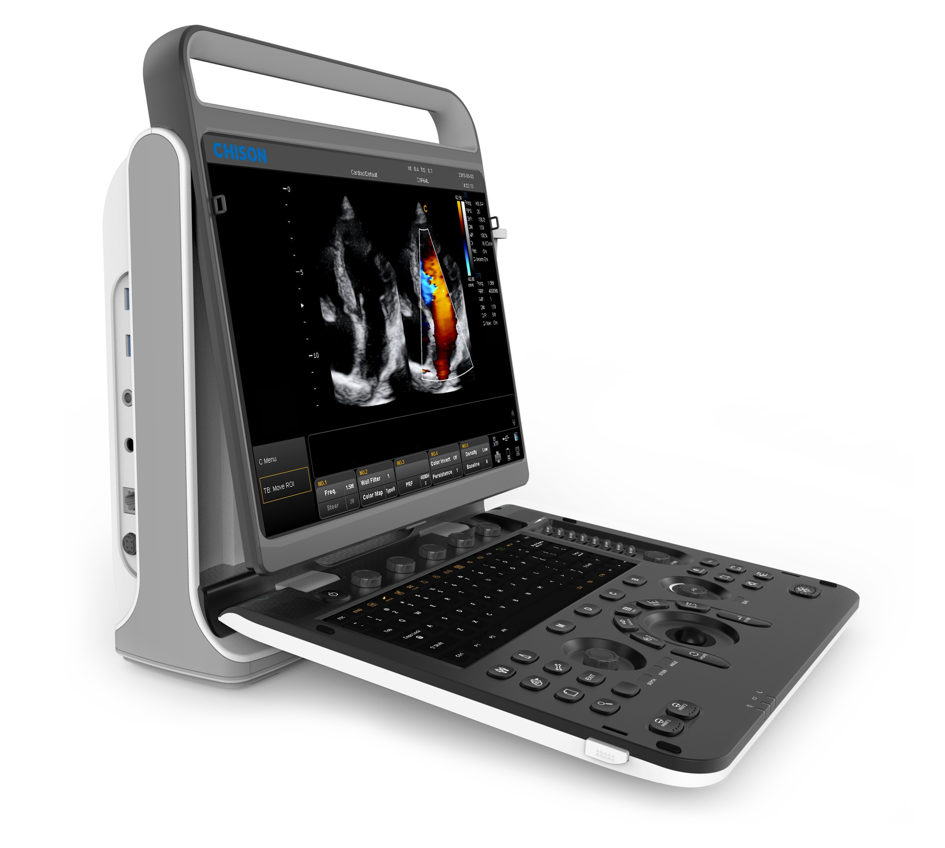 sonotouch 60 — УЗИ CHISON